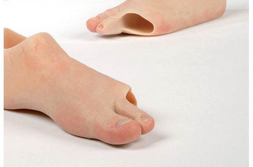 Prothèse de pied en silicone - reha team - ortho team